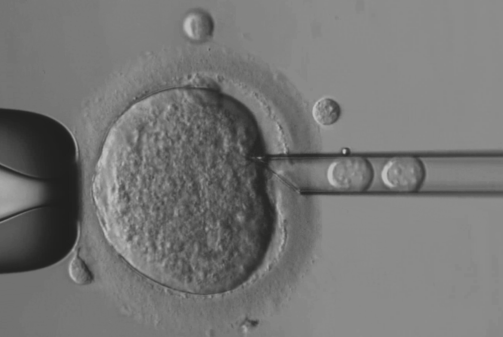 Cytoplasmic Transfer - Fertility Solutions