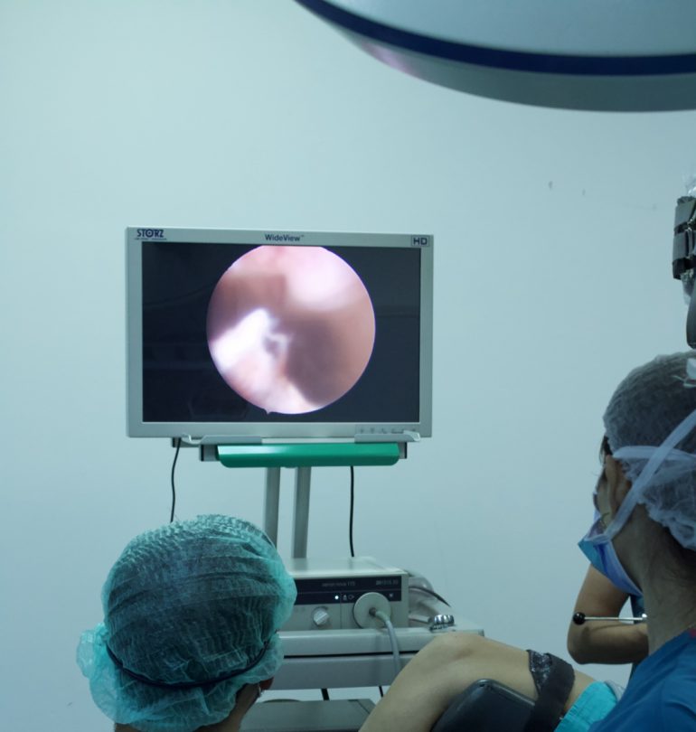 What is a Hysteroscopy Procedure? - Fertility Solutions